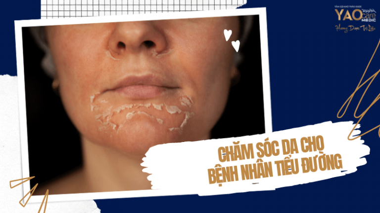 Chăm sóc da cho bệnh nhân tiểu đường - Yaocare Medic