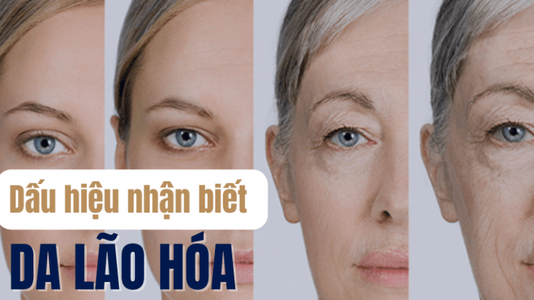 7 Dấu hiệu nhận biết làn da lão hóa - Yaocare Medic